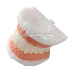 Dental Composite Veneer Template Model Practise Veneers Dentist ...