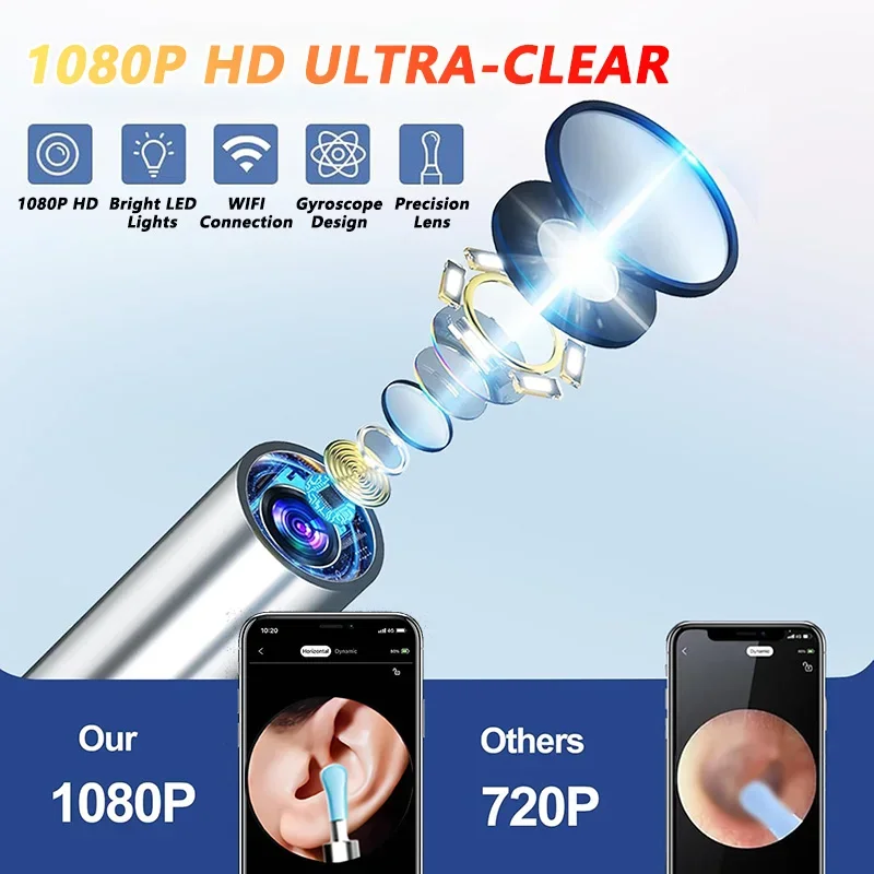 Visual Ear Wax Cleaner with Camera Safe Earwax Removal Endoscope with ...