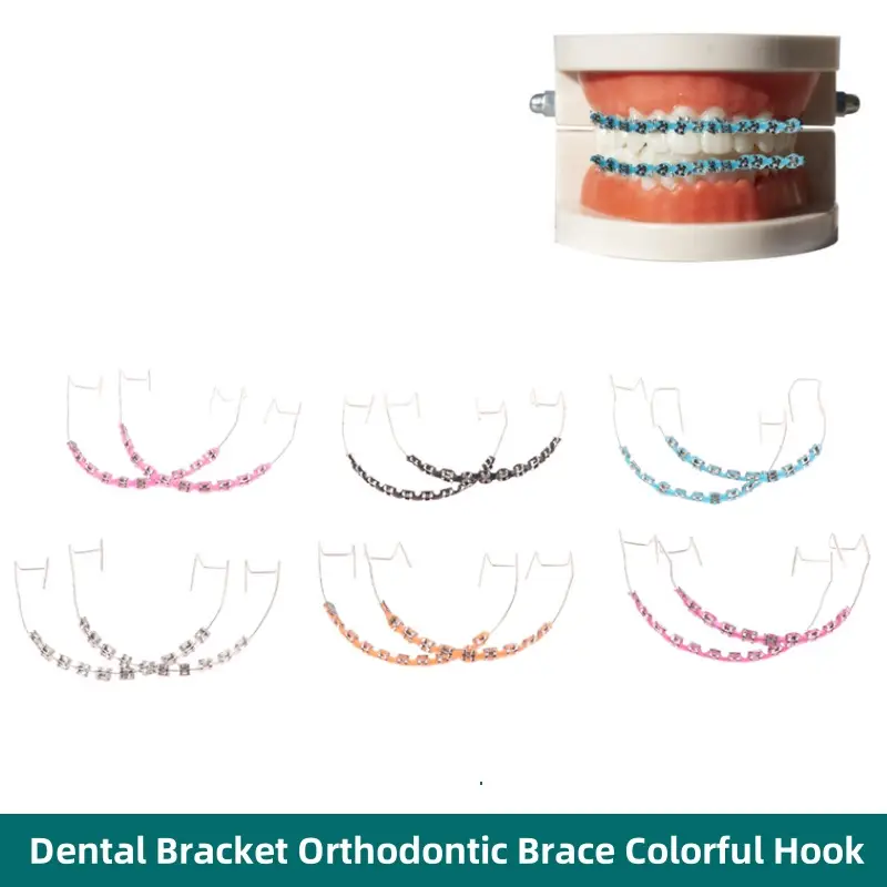 Colorful Dental Braces Hooks, Orthodontic Decorations, Metal Wires ...