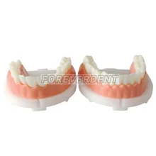 Dental Composite Veneer Template Model Practise Veneers Dentist ...